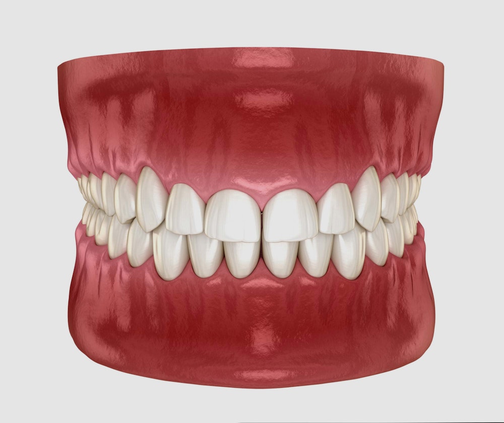 Periodontics Orland Park, IL - Premier Dental & Implant Center