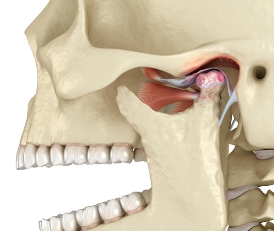 TMJ Treatment Clearfield, UT - Layton, UT - TMD Treatment - The Oral ...