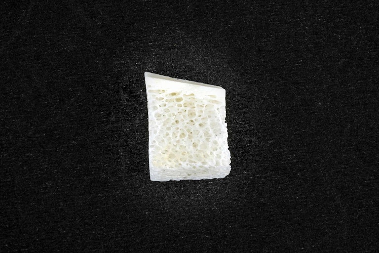 Bone Grafting Fairfax, VA - Fairfax Family Dental Care